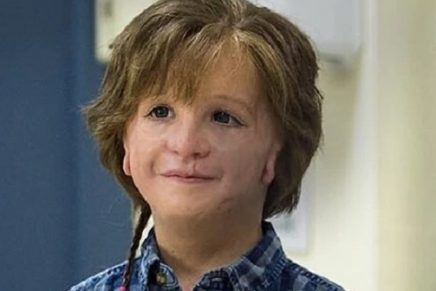 “Extraordinario”: así luce, en la vida real, el protagonista de esta ...