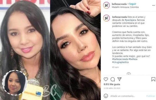 Usuarios dicen que por el exceso de cirugías a Paola Jara se le “deformó” la nariz
