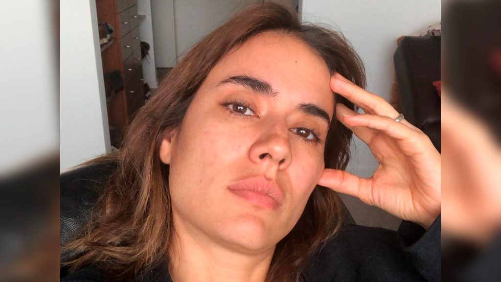 Carolina Ramírez sufrió accidente en proceso de belleza y así quedó su piel