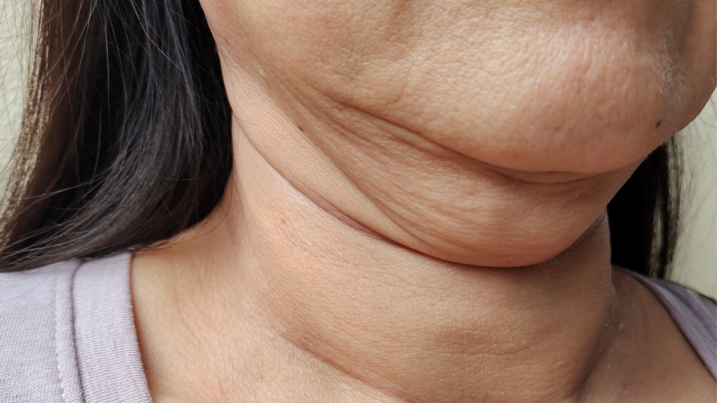 ejercicios sencillos para eliminar la papada